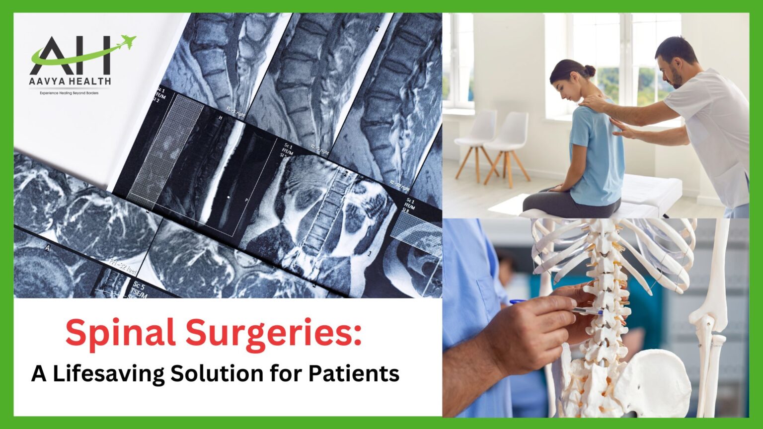 Spinal Surgeries: A Lifesaving Solution for Patients in Africa - Aavya ...